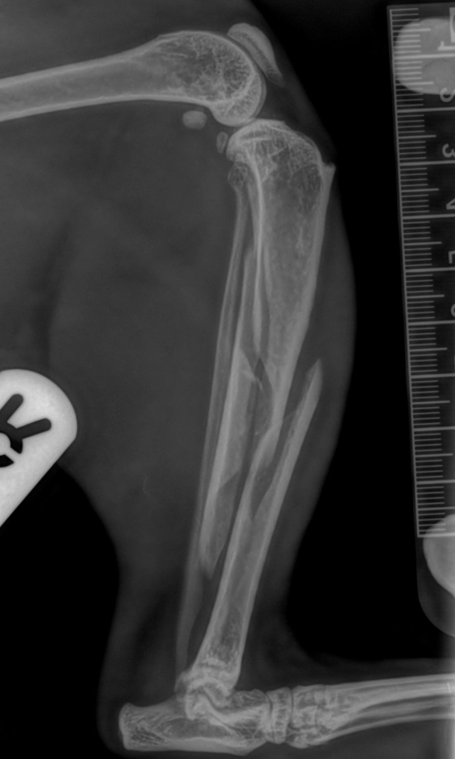 Tilly – tibial fracture to right hind leg – Tonbridge Vets